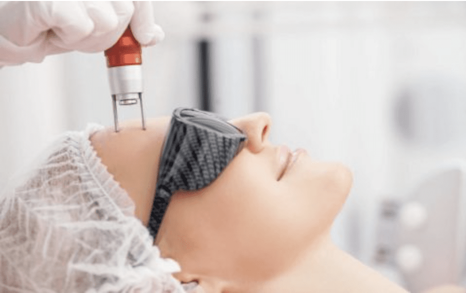 Skin Aesthetic Laser - LiV Clinic